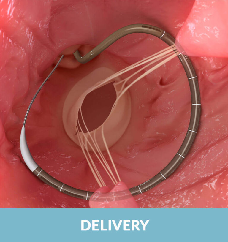 Physicians | Heart Treatment Options | Ancora Heart